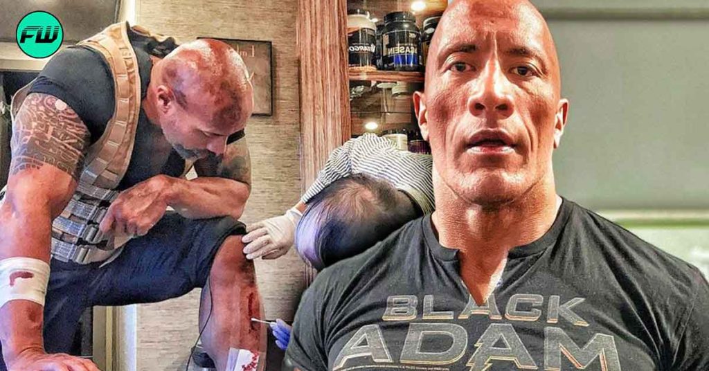 "I had to be sewn back together": Dwayne Johnson's Life is Full of ...