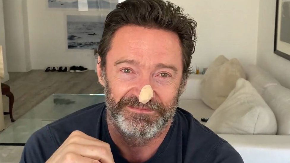 "I'm still in a little shock, I was worried": Hugh Jackman Was Stunned ...