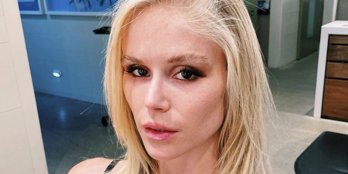 Erin Moriarty’s Before and After Pictures: Why Are Fans Accusing The Boys Star of Plastic Surgery?