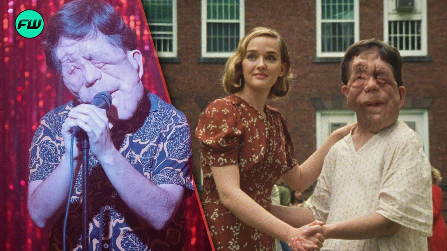 What Is Neurofibromatosis? Condition Behind Adam Pearson's Face