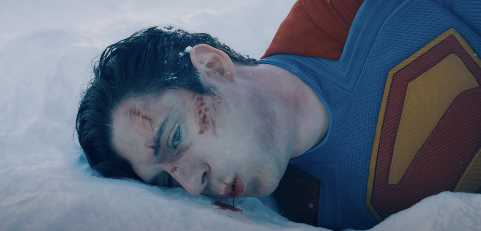 The Difference Between Henry Cavill and David Corenswet Healing From ...